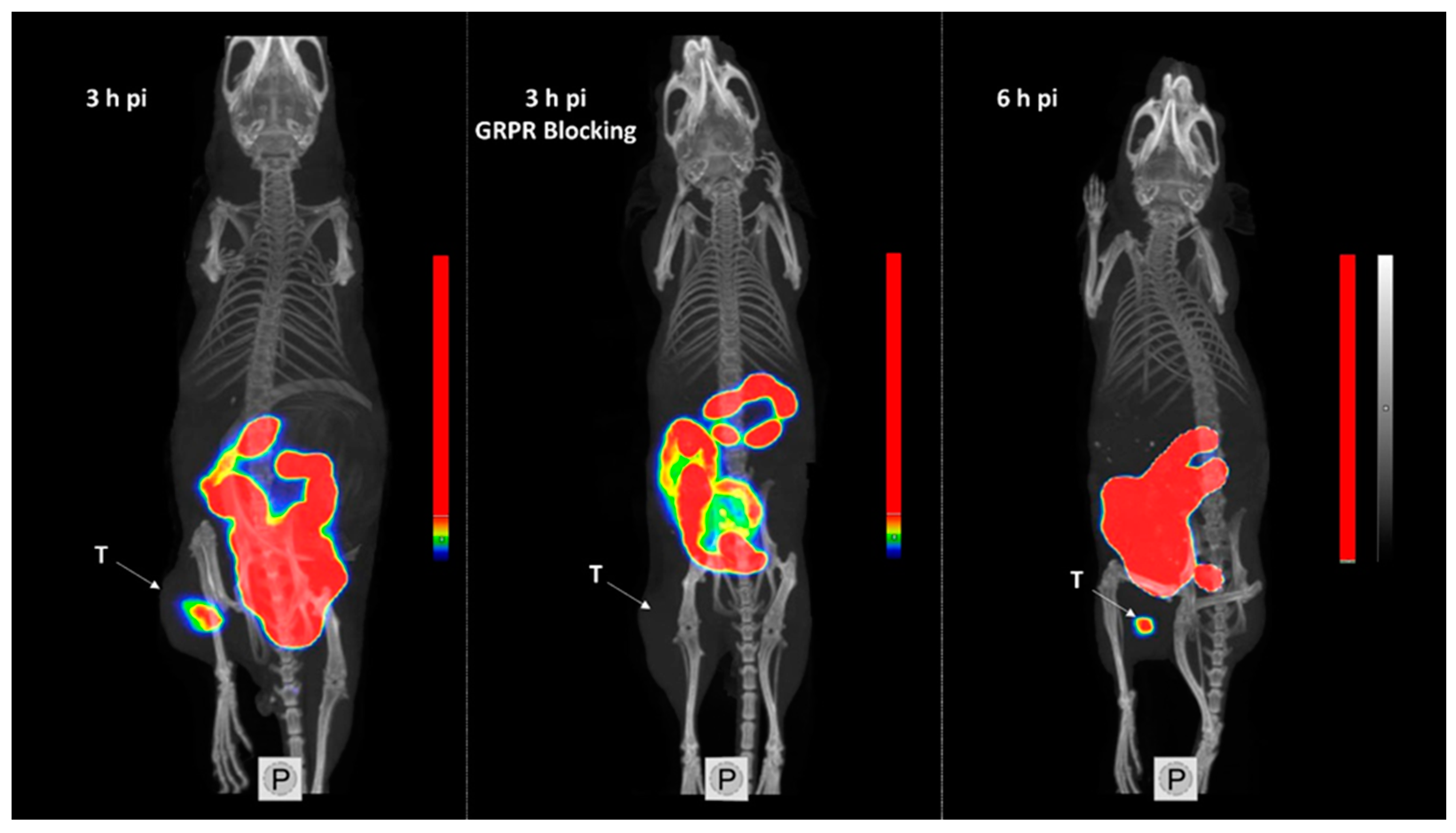 Preclinical Evaluation of 99mTc-Labeled GRPR Antagonists maSSS/SES-PEG2 ...
