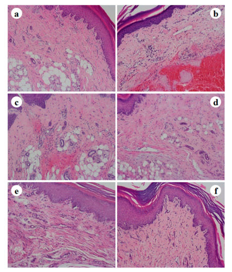 Increased Therapeutic Efficacy of SLN Containing Etofenamate and ...