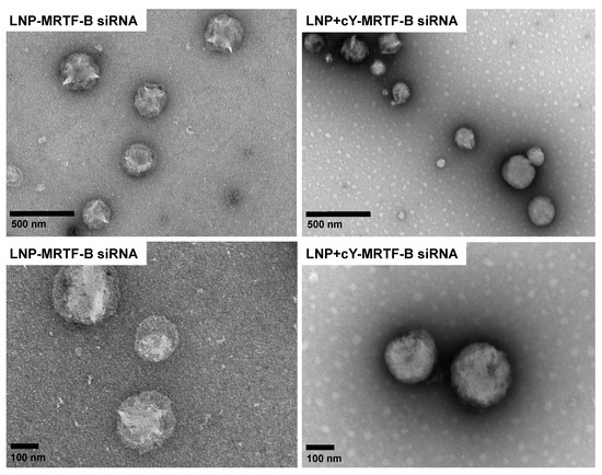 Novel PEGylated Lipid Nanoparticles Have a High Encapsulation Efficiency and Effectively Deliver ...