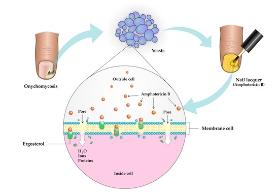 Pharmaceutics | Free Full-Text | Polishing the Therapy of Onychomycosis ...