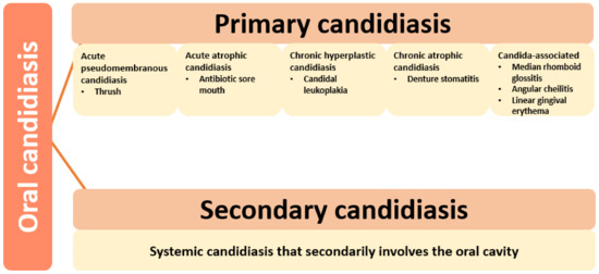 Biomaterials for the Prevention of Oral Candidiasis Development