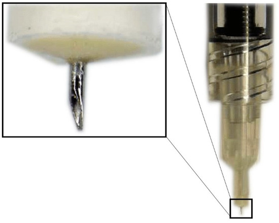 Drug Delivery via the Suprachoroidal Space for the Treatment of Retinal ...