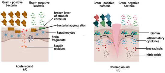 The Insights of Microbes’ Roles in Wound Healing: A Comprehensive Review