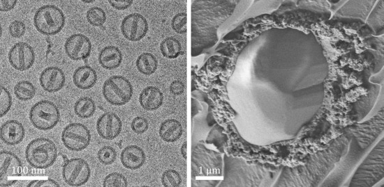 Pharmaceutics | Free Full-Text | Cryogenic Electron Microscopy ...