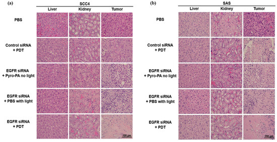 Novel Pyropheophorbide Phosphatydic Acids Photosensitizer Combined EGFR ...