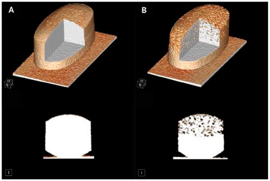 Gastroretentive Technologies in Tandem with Controlled-Release ...