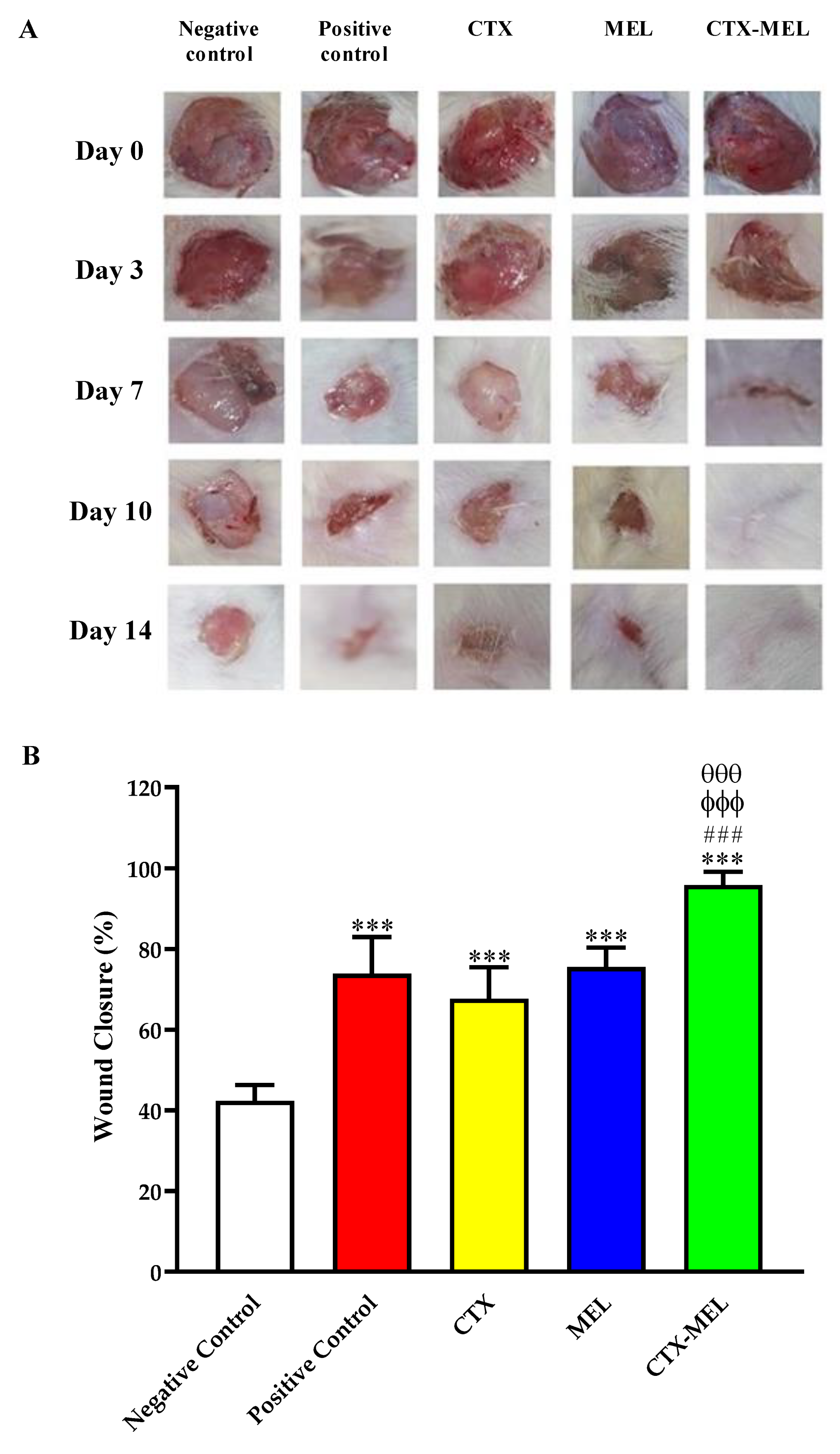 RETRACTED: Ceftriaxone and Melittin Synergistically Promote Wound ...
