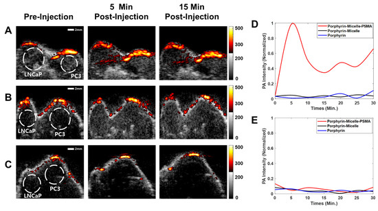 PMP(Porphyrin–Micelle–PSMA) Nanoparticles for Photoacoustic and ...