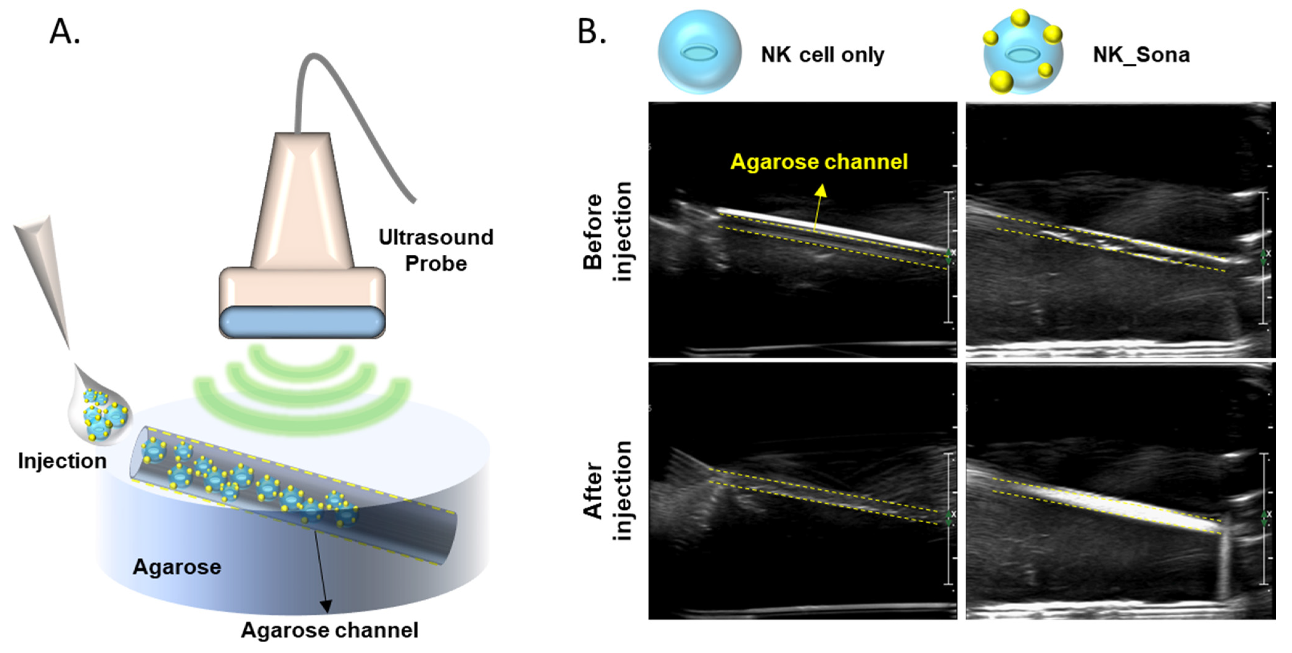 Pharmaceutics | Free Full-Text | Sonazoid-Conjugated Natural Killer ...