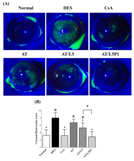 Development of Lutein-Containing Eye Drops for the Treatment of Dry Eye ...