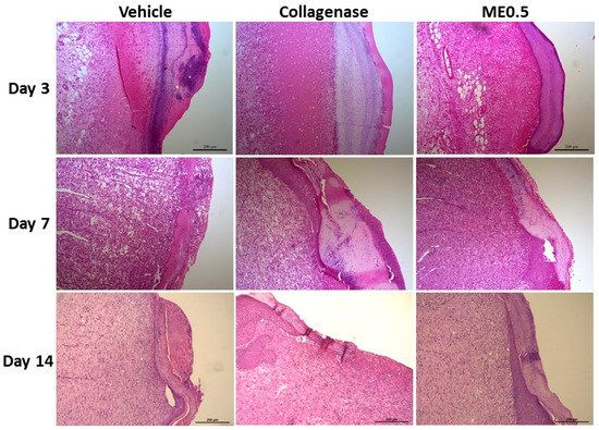 The Use of Menthol in Skin Wound Healing—Anti-Inflammatory Potential ...