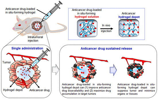 Advances in Injectable In Situ-Forming Hydrogels for Intratumoral Treatment