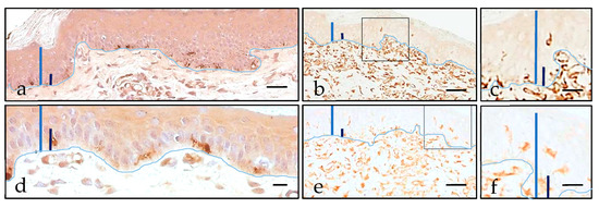 Transdermal Drug Delivery in the Pig Skin