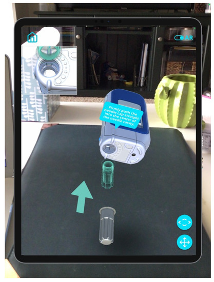 Medical Device Development for Children and Young People—Reviewing the ...