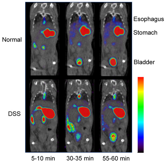 Biological Distribution of Orally Administered [123I]MIBG for ...