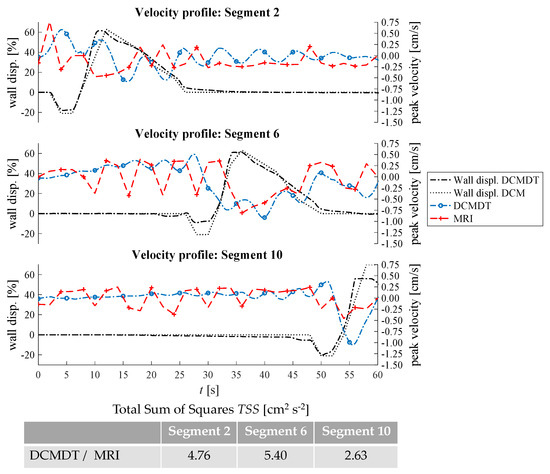 Simulating the Hydrodynamic Conditions of the Human Ascending Colon: A ...