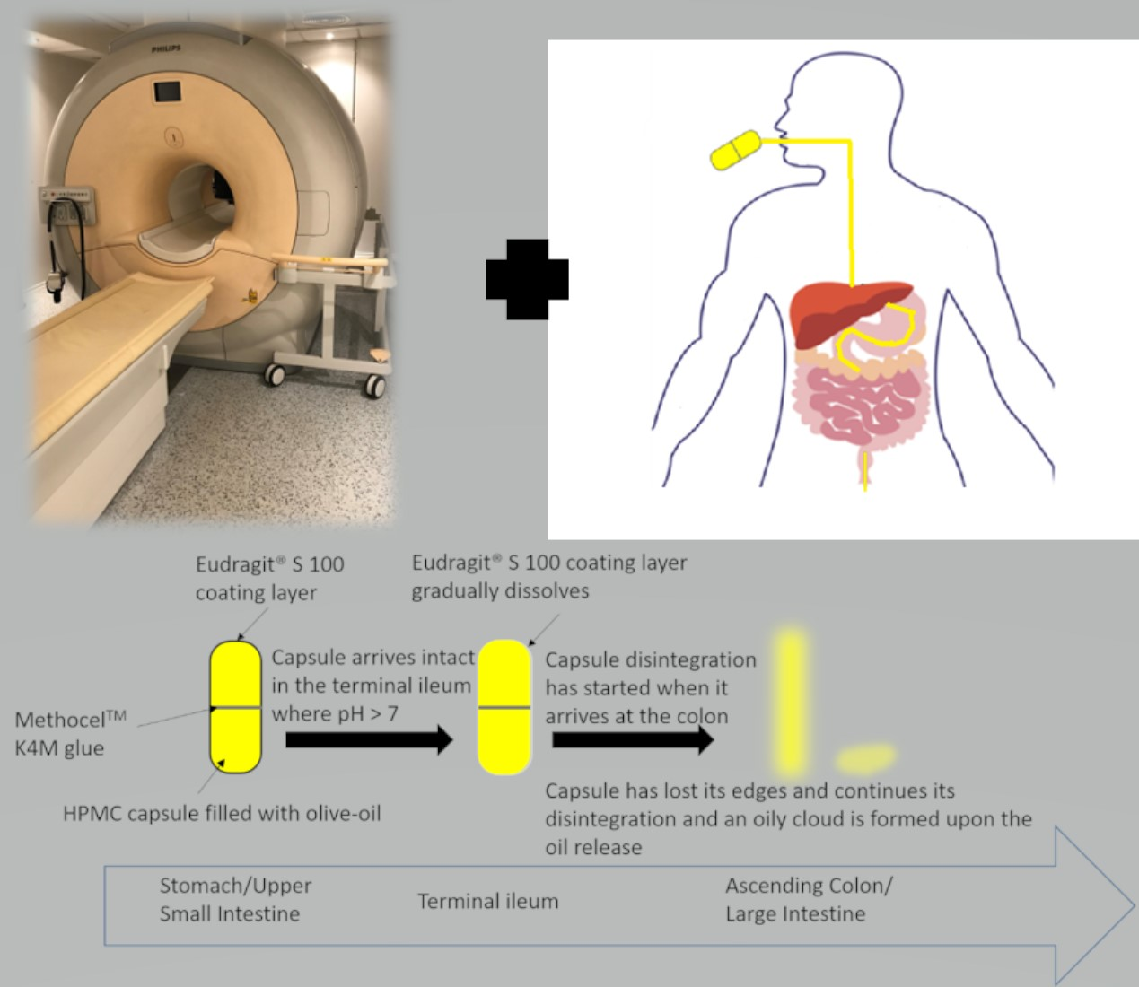 Pharmaceutics | Free Full-Text | Application of In Vivo MRI Imaging to ...