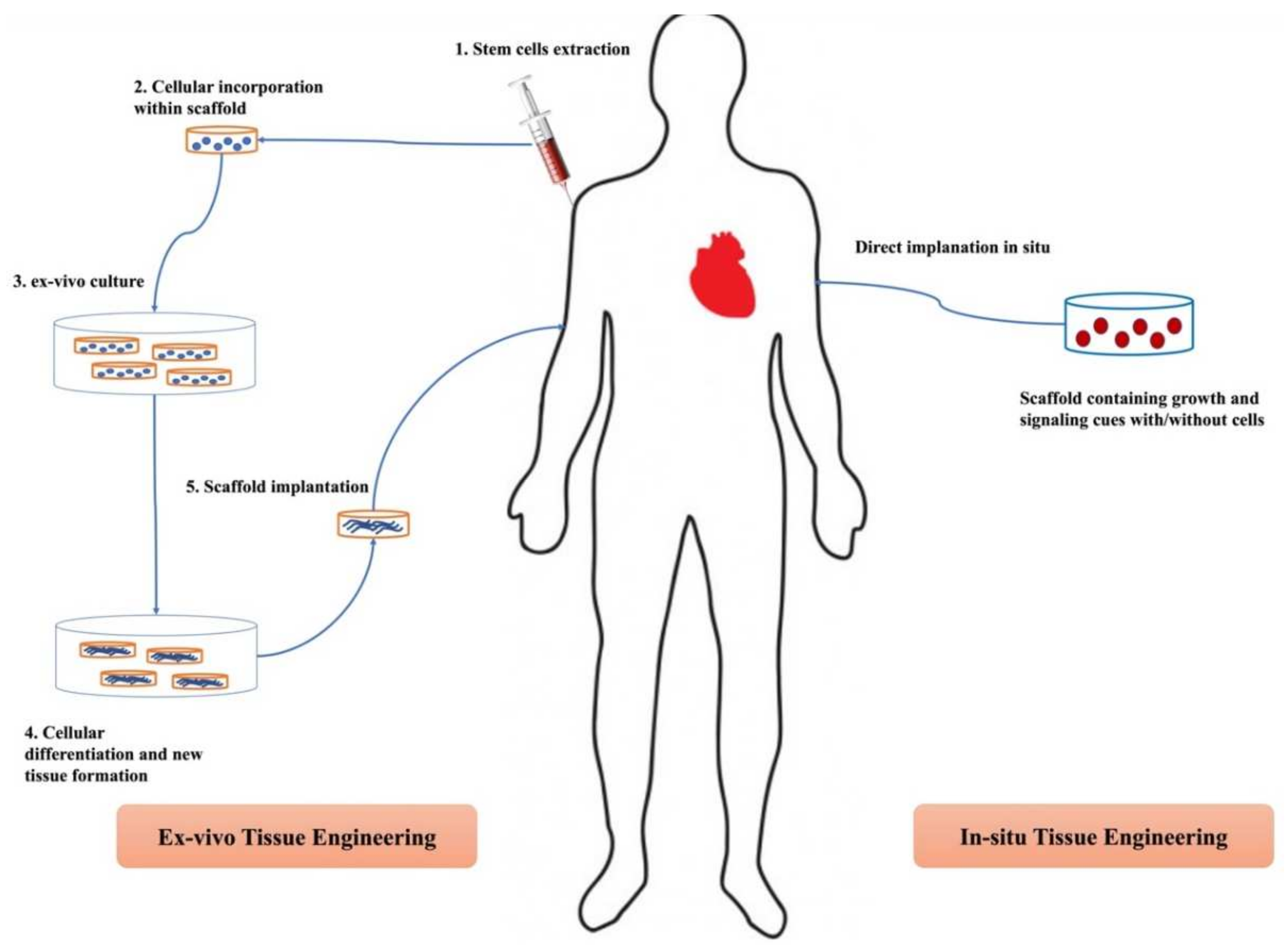 Conventional and Recent Trends of Scaffolds Fabrication: A Superior ...