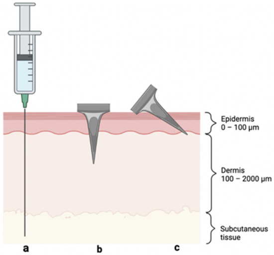 Pharmaceutics | Free Full-Text | Angled Insertion of Microneedles for ...