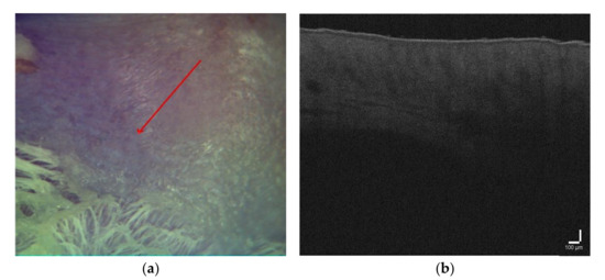 The In Vivo Quantitative Assessment of the Effectiveness of Low-Dose ...