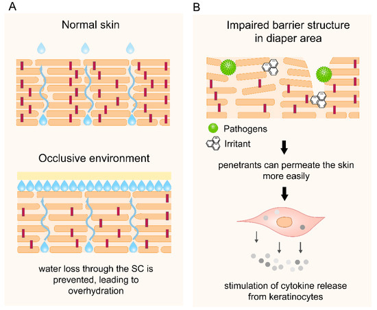 Skin Barrier Function in Infants: Update and Outlook