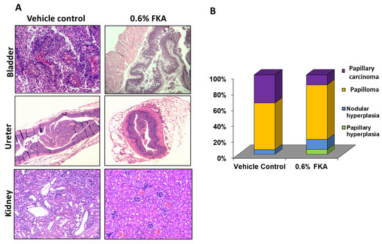 Chemoprevention of Urothelial Cell Carcinoma Tumorigenesis by Dietary ...