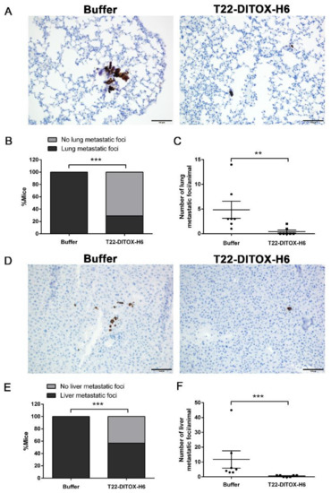 A Novel CXCR4-Targeted Diphtheria Toxin Nanoparticle Inhibits Invasion ...