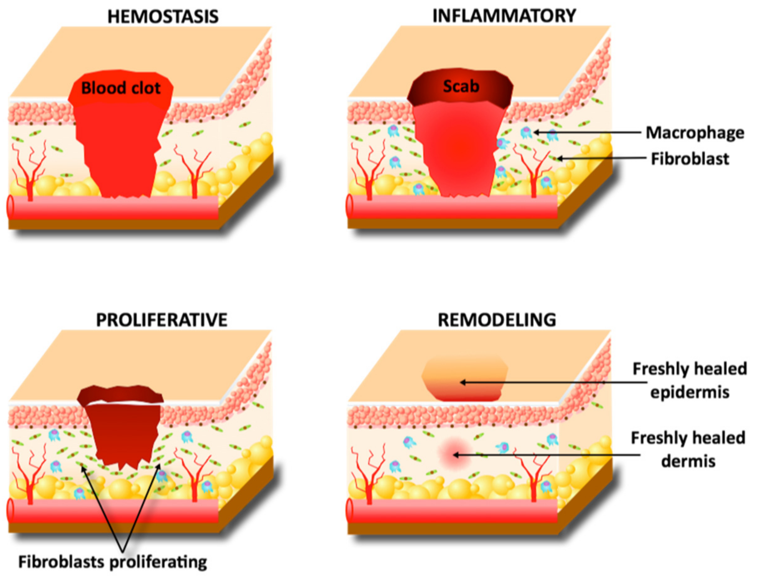 Advancements in Skin Delivery of Natural Bioactive Products for Wound ...