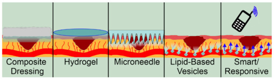 Pharmaceutics | Free Full-Text | Advancements in Skin Delivery of ...