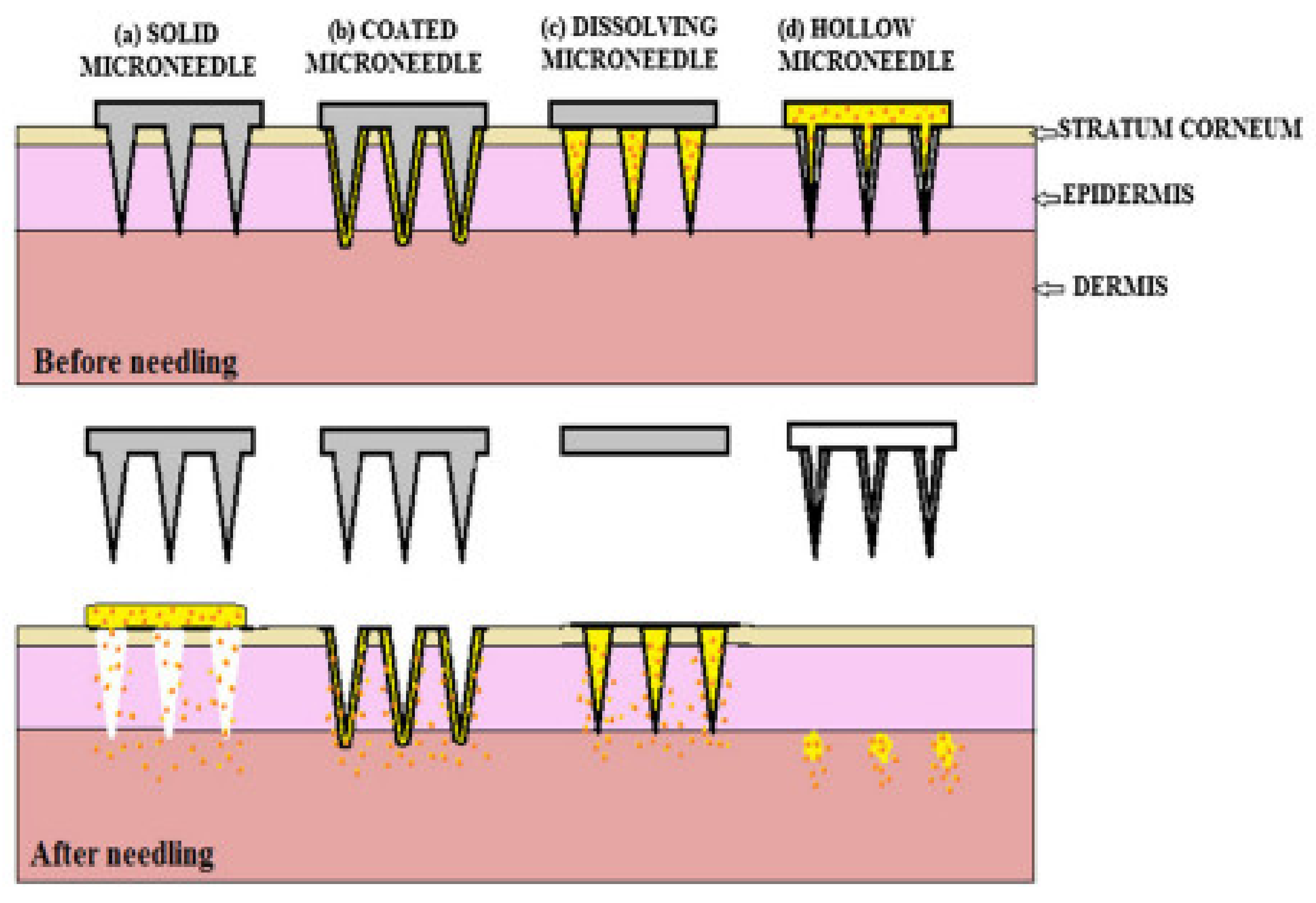 Recent Advancements in Microneedle Technology for Multifaceted ...
