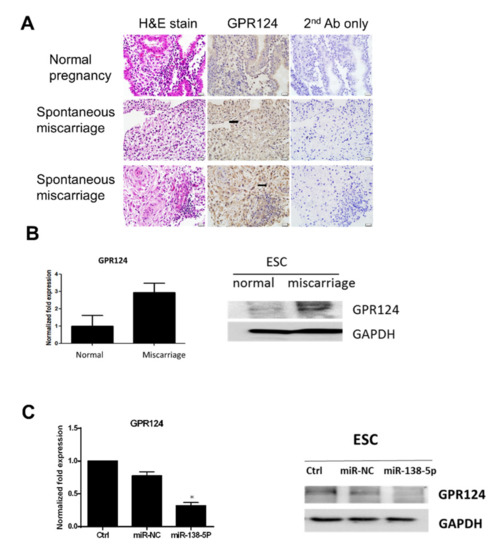 Extracellular Vesicle-Associated MicroRNA-138-5p Regulates Embryo ...