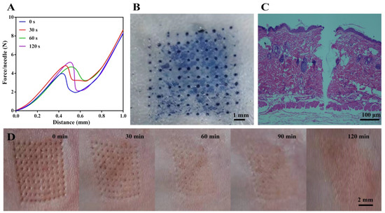 Pharmaceutics | Free Full-Text | Dual-Drug Loaded Separable ...