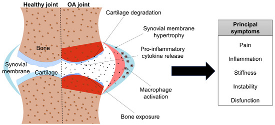 Progress in 3D Bioprinting Technology for Osteochondral Regeneration
