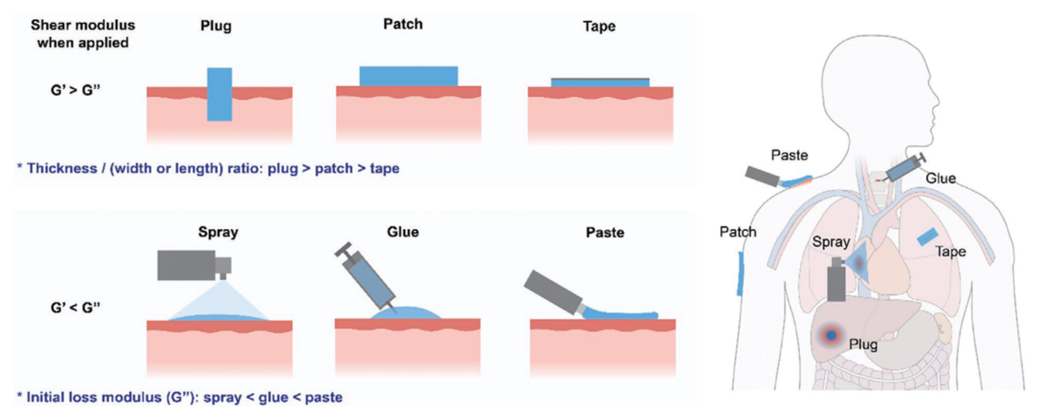 Pharmaceutics | Free Full-Text | Supramolecular Adhesive Materials with ...