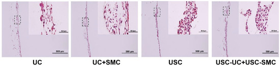 Urine-Derived Stem Cells for Epithelial Tissues Reconstruction and ...