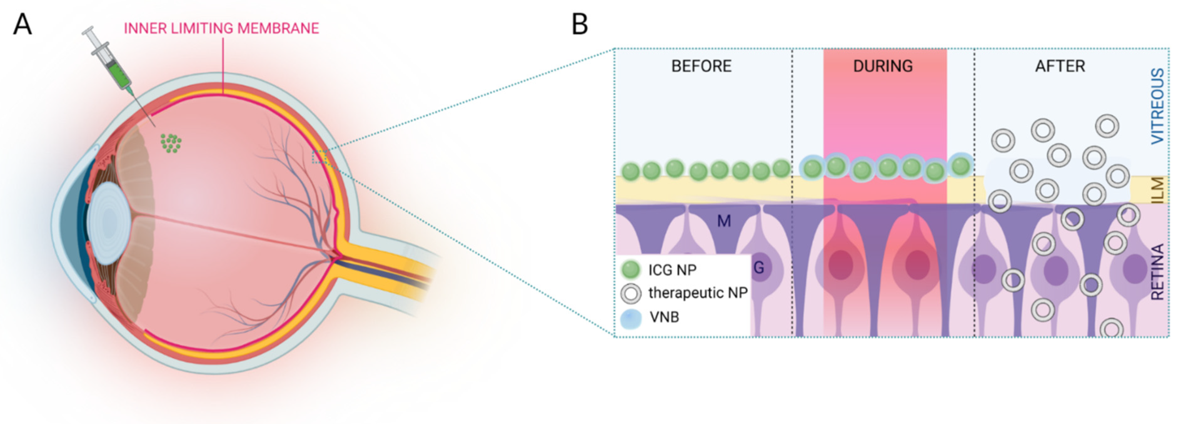 Internal Limiting Membrane Eye