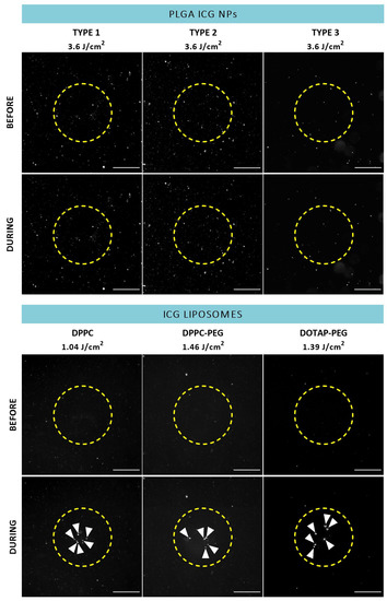 Photodisruption of the Inner Limiting Membrane: Exploring ICG Loaded ...