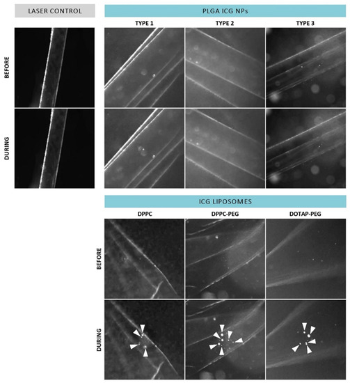 Photodisruption of the Inner Limiting Membrane: Exploring ICG Loaded ...