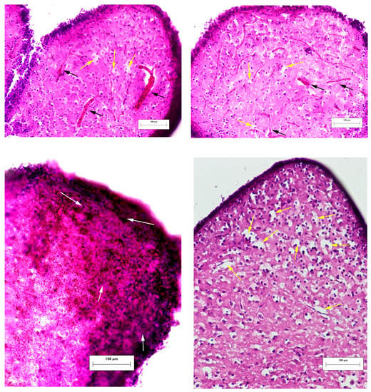 A Novel Laser-Based Zebrafish Model for Studying Traumatic Brain Injury ...