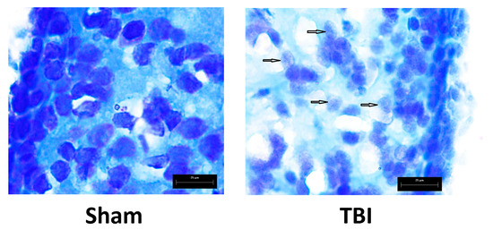 A Novel Laser-Based Zebrafish Model for Studying Traumatic Brain Injury ...