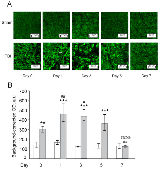 A Novel Laser-Based Zebrafish Model for Studying Traumatic Brain Injury ...