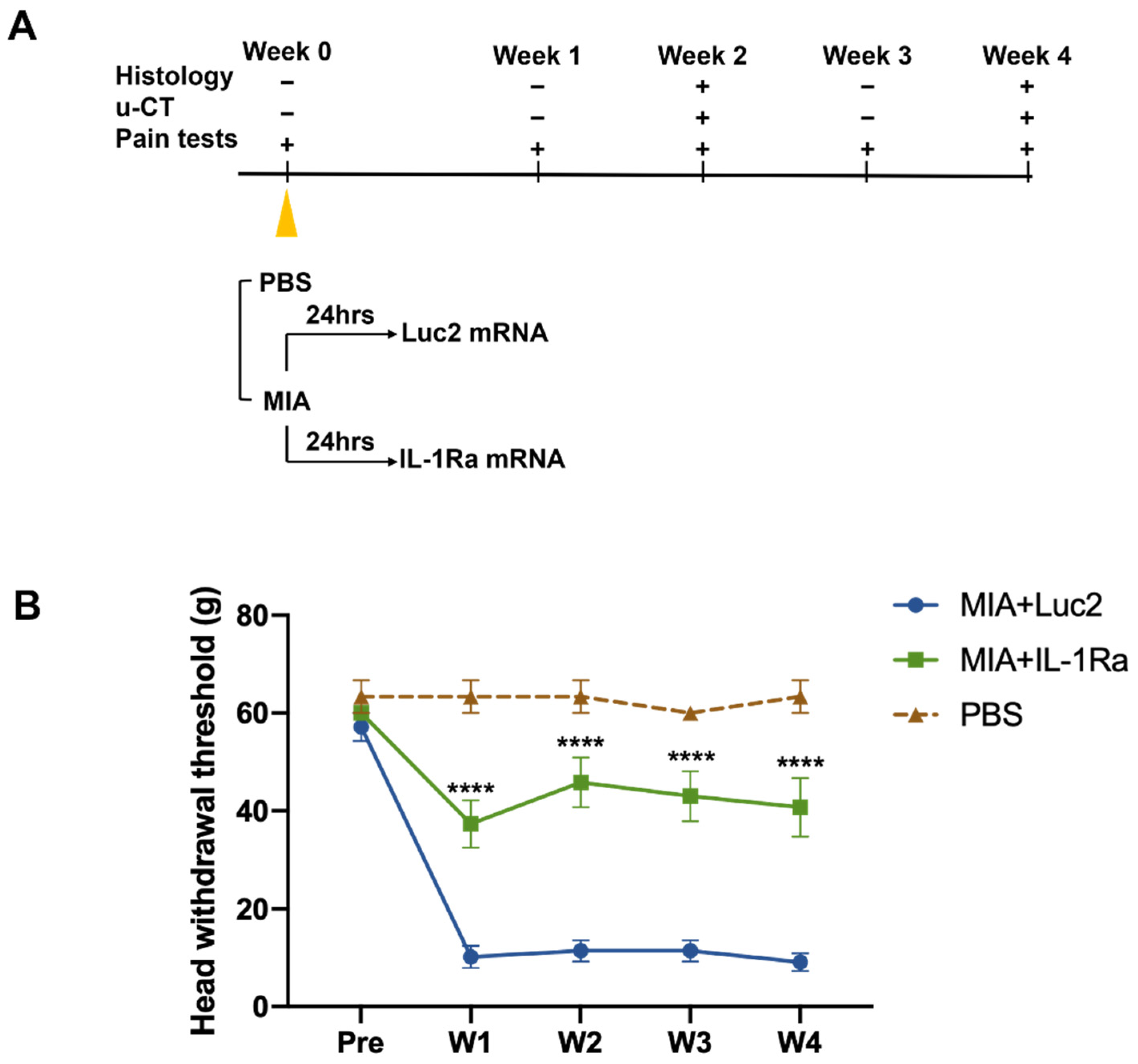 Anti-Inflammatory Therapy for Temporomandibular Joint Osteoarthritis ...