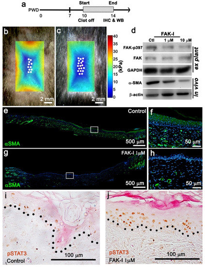 Topological Distribution of Wound Stiffness Modulates Wound-Induced ...