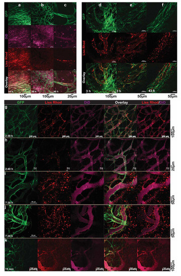 Liposomal Drug Delivery Systems for Cancer Therapy: The Rotterdam ...