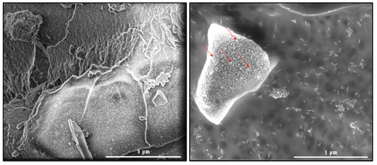 Pharmaceutics | Free Full-Text | β-Cyclodextrin-Based Nanosponges ...