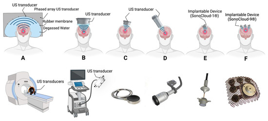 Harnessing Ultrasound for Targeting Drug Delivery to the Brain and ...
