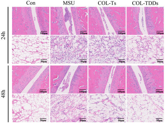 Formulation and Evaluation of a Drug-in-Adhesive Patch for Transdermal ...