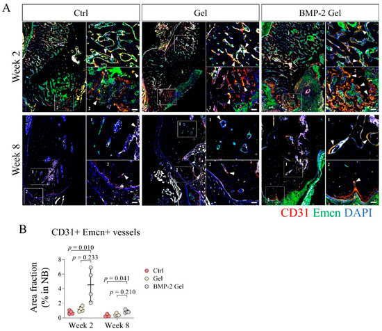Controlled Release of Bone Morphogenetic Protein-2 Augments the ...
