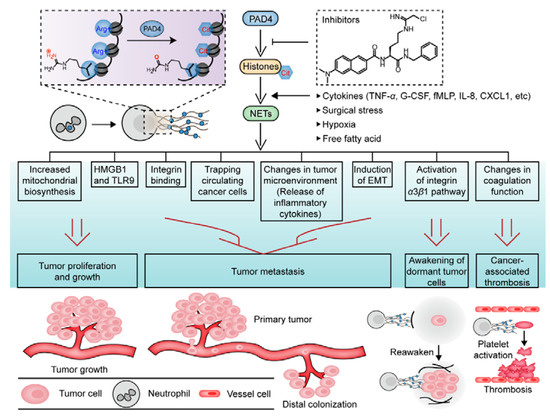 PAD4 and Its Inhibitors in Cancer Progression and Prognosis