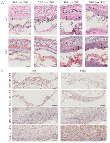 Immunomodulatory PEG-CRGD Hydrogels Promote Chondrogenic ...